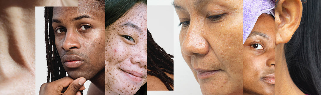 SOS Skin Emergencies (Buy One Get One 50% Off) – IF Beauty Australia